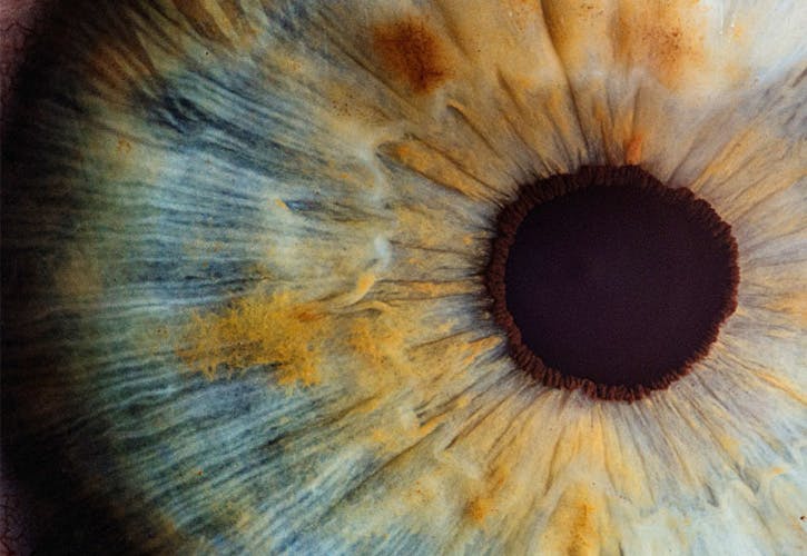 Braune Augen Iris Von Der Iris Spektrum Der Wissenschaft